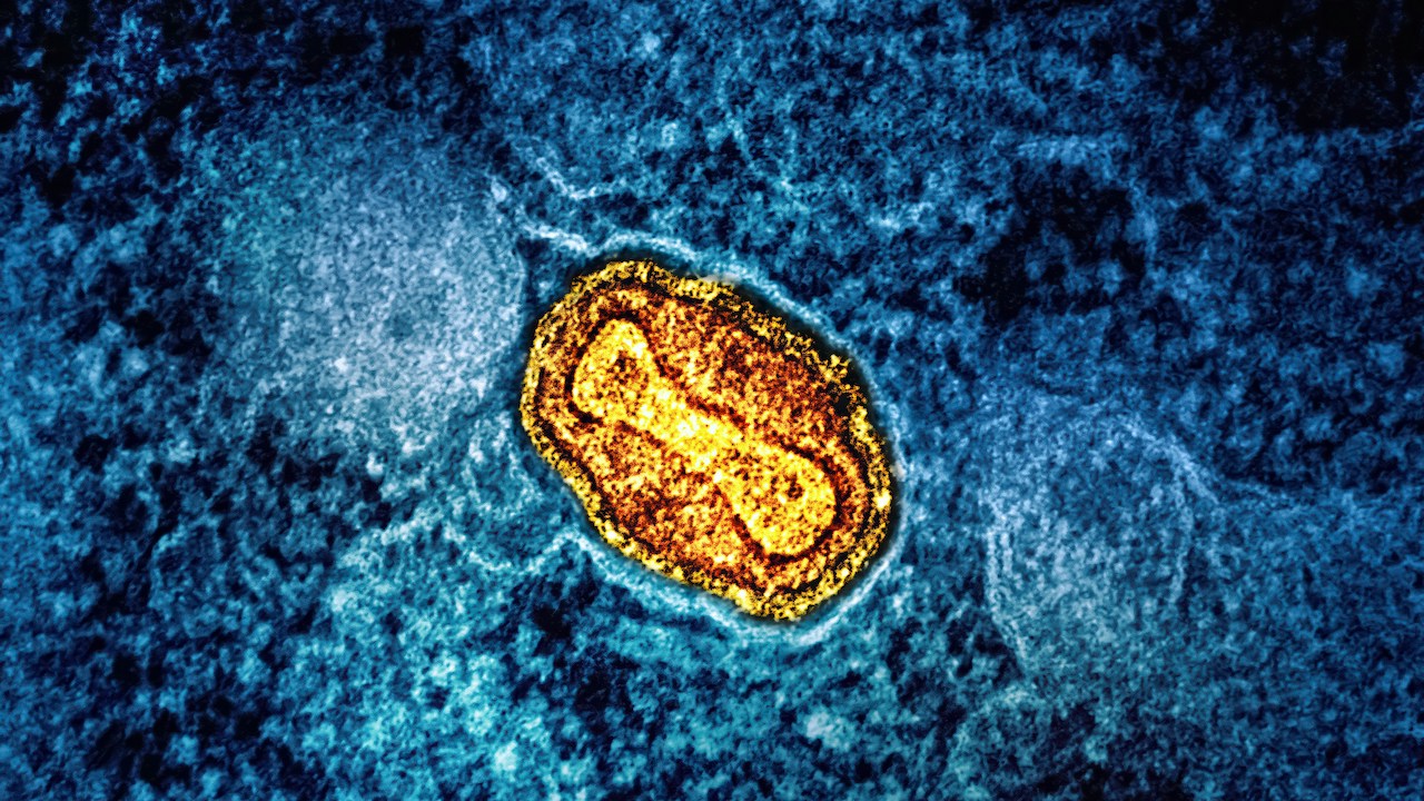 Everything you need to know about Mpox as case numbers approach 100 ...